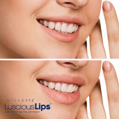Luscious Lips - madonna24.at