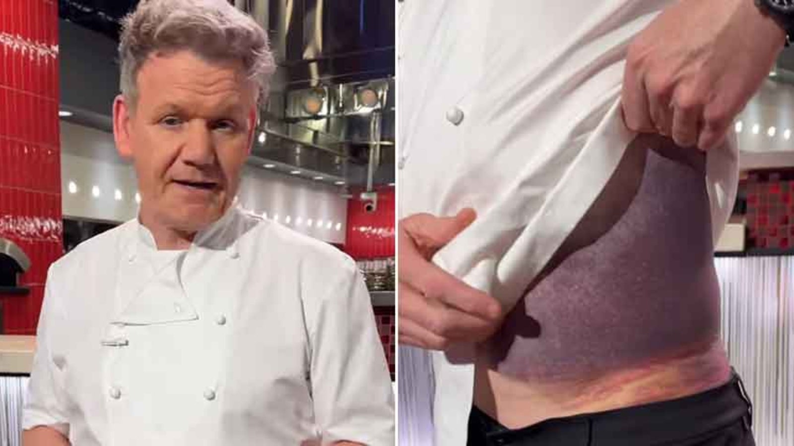 Gordon Ramsay schockt mit Horror-Rad-Verletzung - oe24.tv