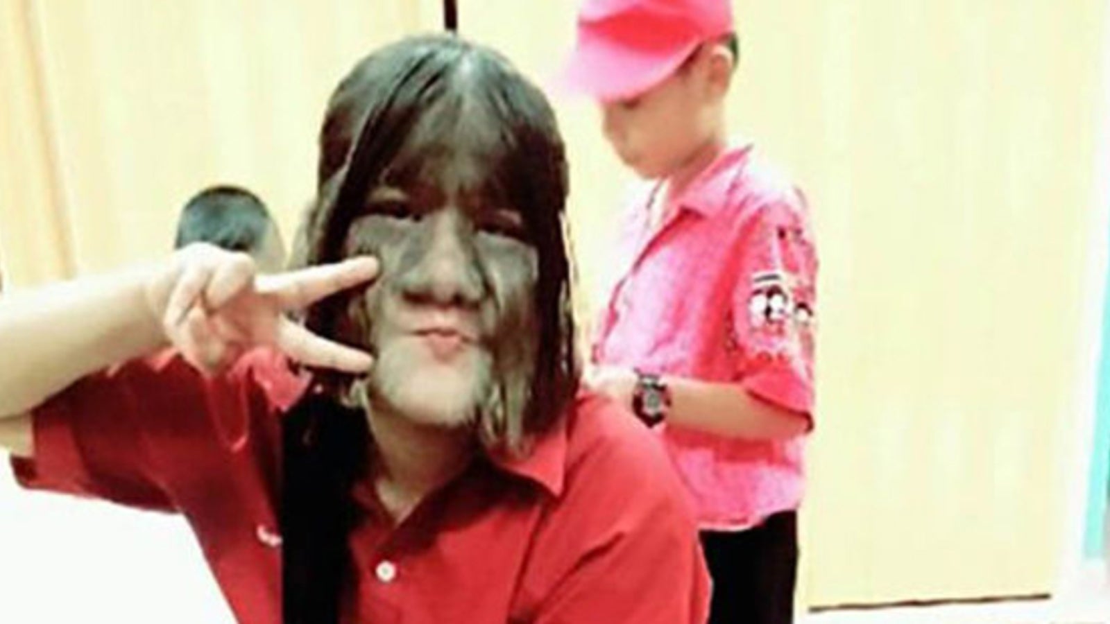 So sieht das "haarigste Mädchen der Welt" heute aus - oe24.at