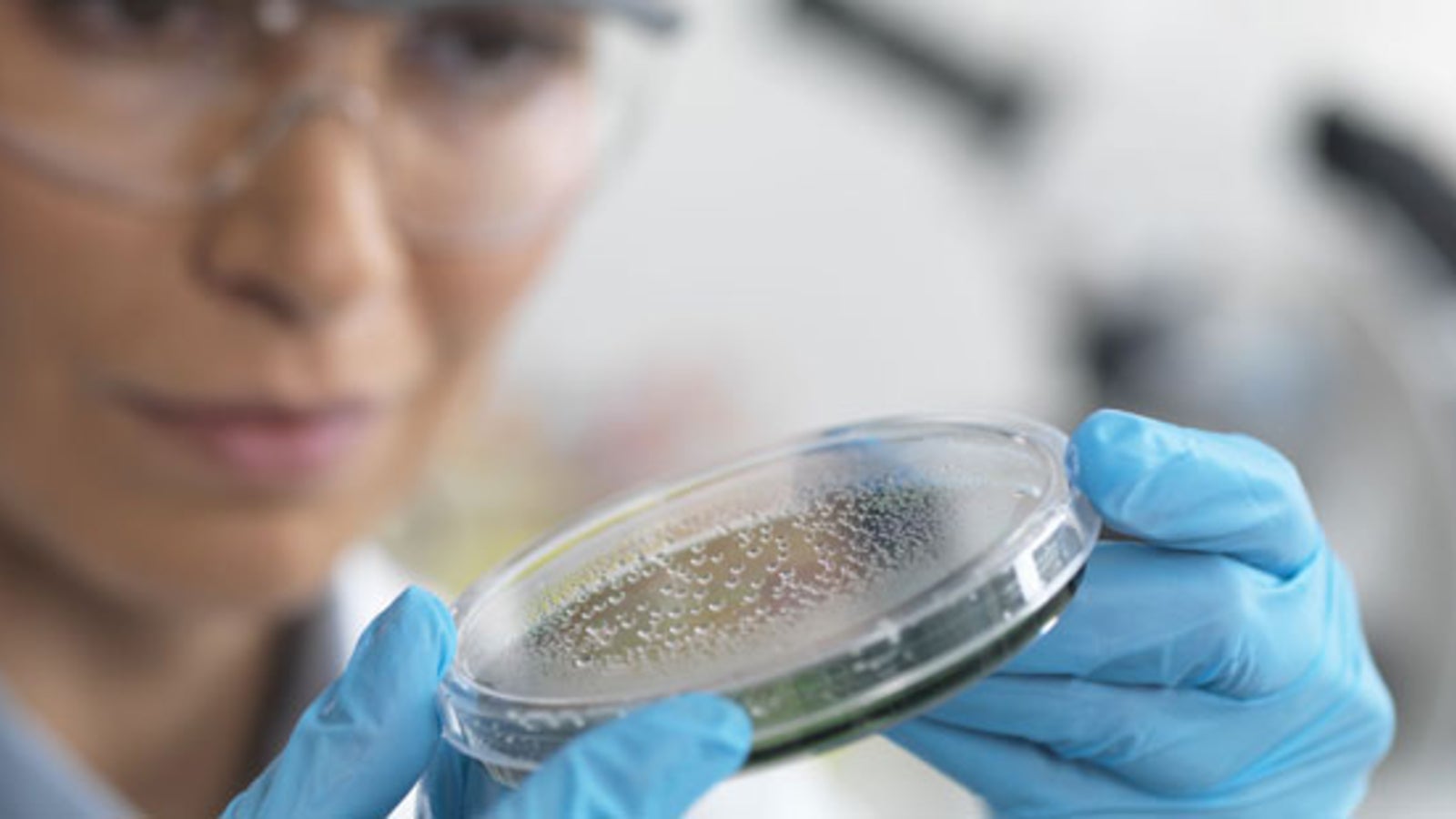 Was sind eigentlich Listerien? - gesund24.at