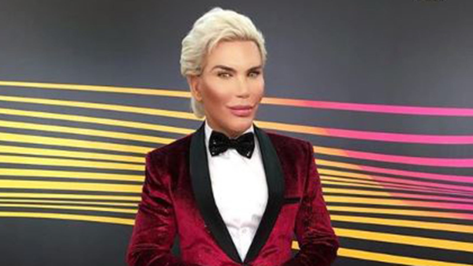 Lebender Ken: Seine OP-Vorsätze fürs neue Jahr - stars24