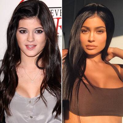 Paris Hilton Vorher Und Nachher